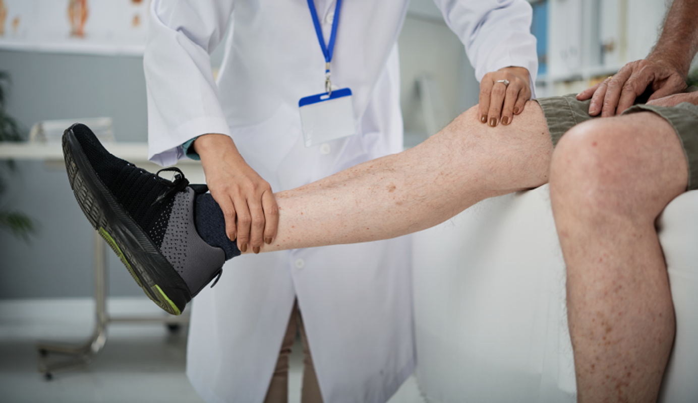 Summer Survival Guide for Varicose Veins and Other Vein Issues ...